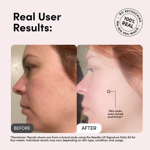 Medi Lift – Needle Lift Signature Daily Kit | Balance, Hydrate, and ...