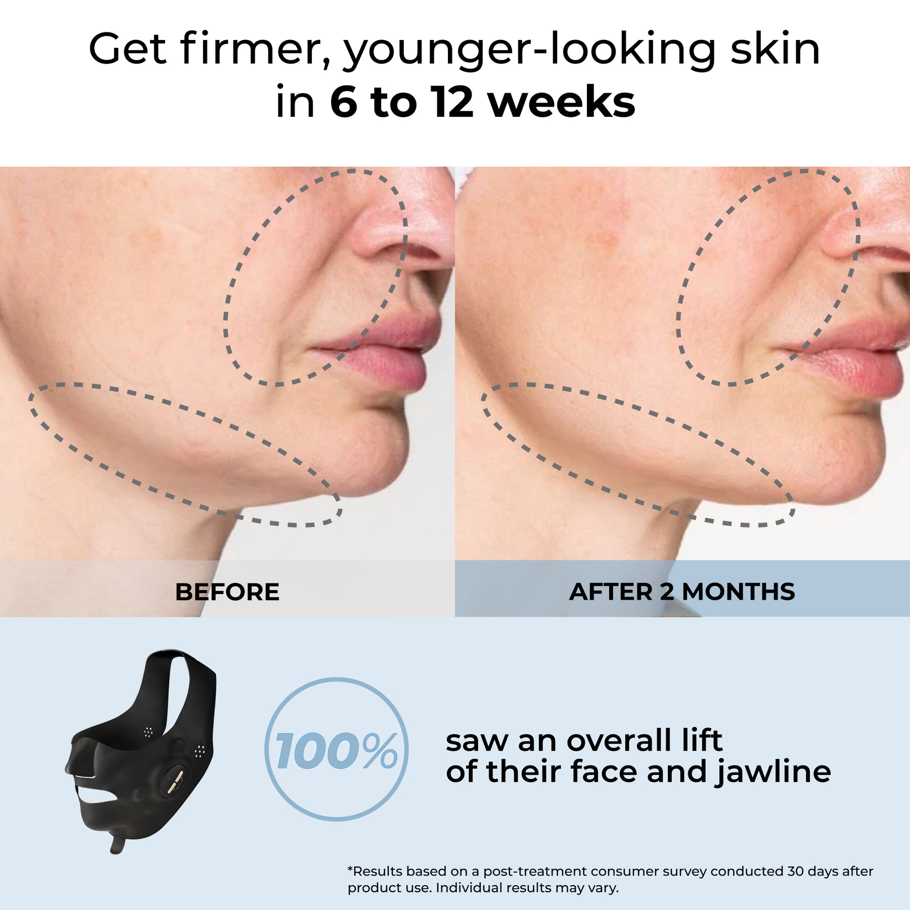 Medi Lift Essential Mask – Lift, Tone, and Tighten Facial Muscle ...